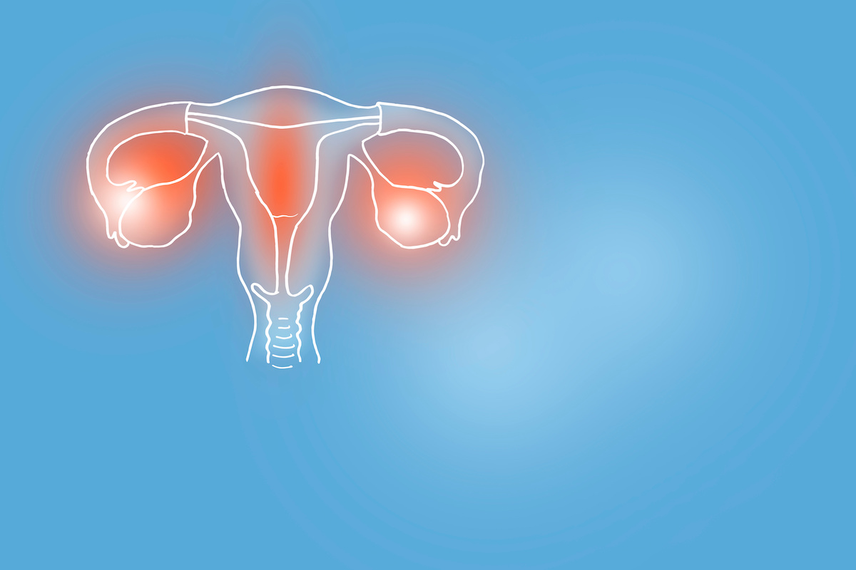 Hysterosalpingogram Hsg Island Reproductive Services